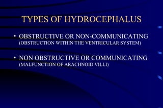 Hydrocephalus | PPT