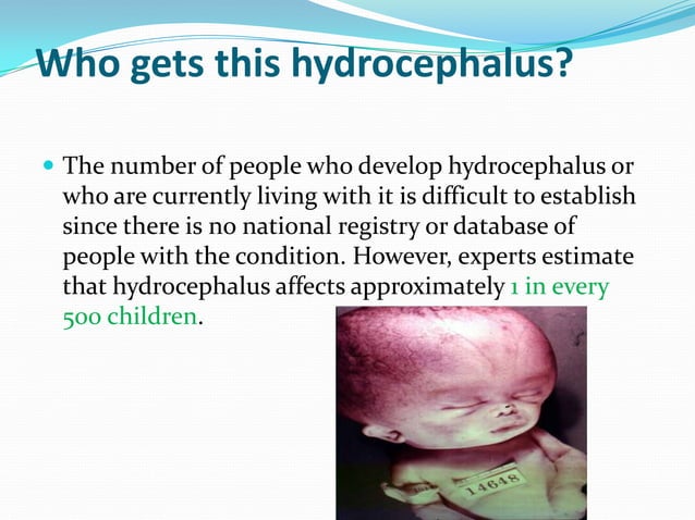 Hydrocephalus | PPTX | Brain and Nervous System Disorders | Diseases ...