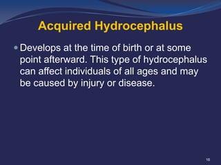 Hydrocephalus | PPTX