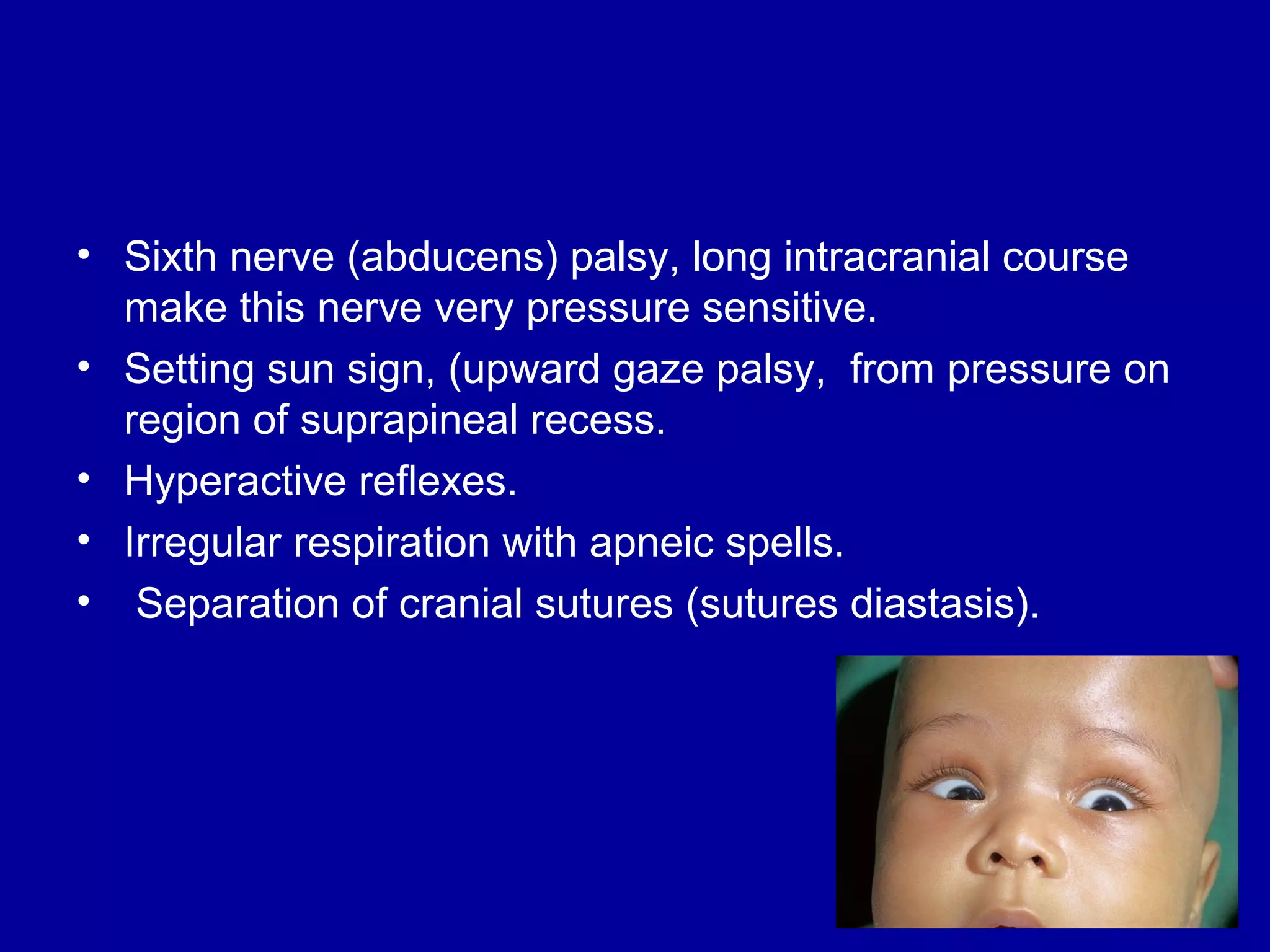 Hydrocephalus | PPT