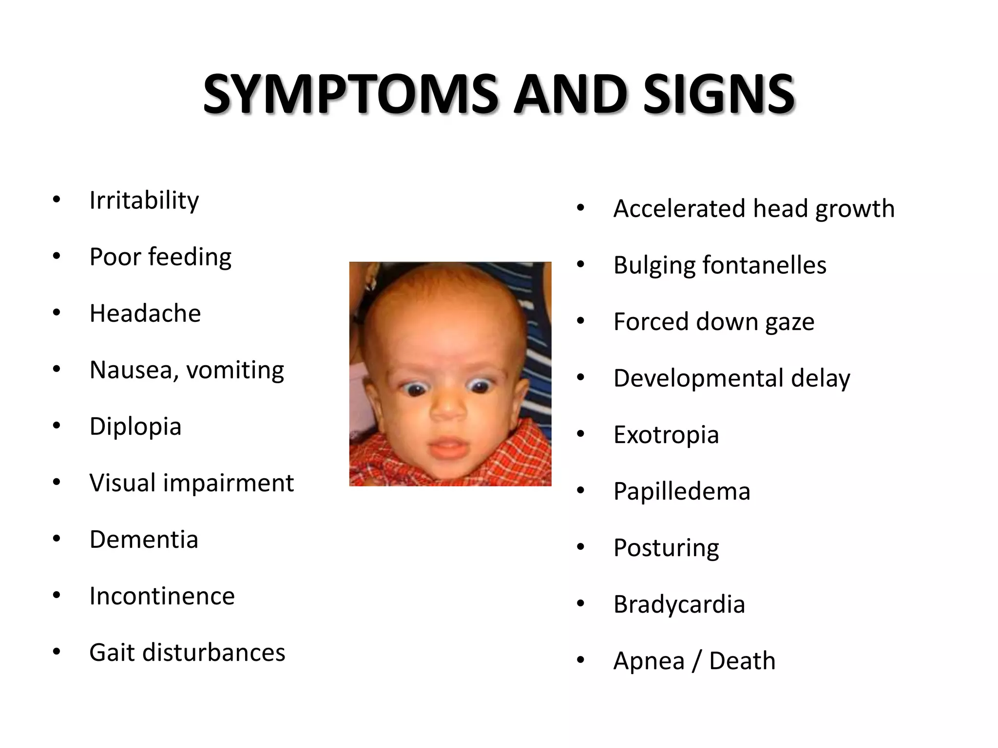 Hydrocephalus diagnosis and management | PPTX
