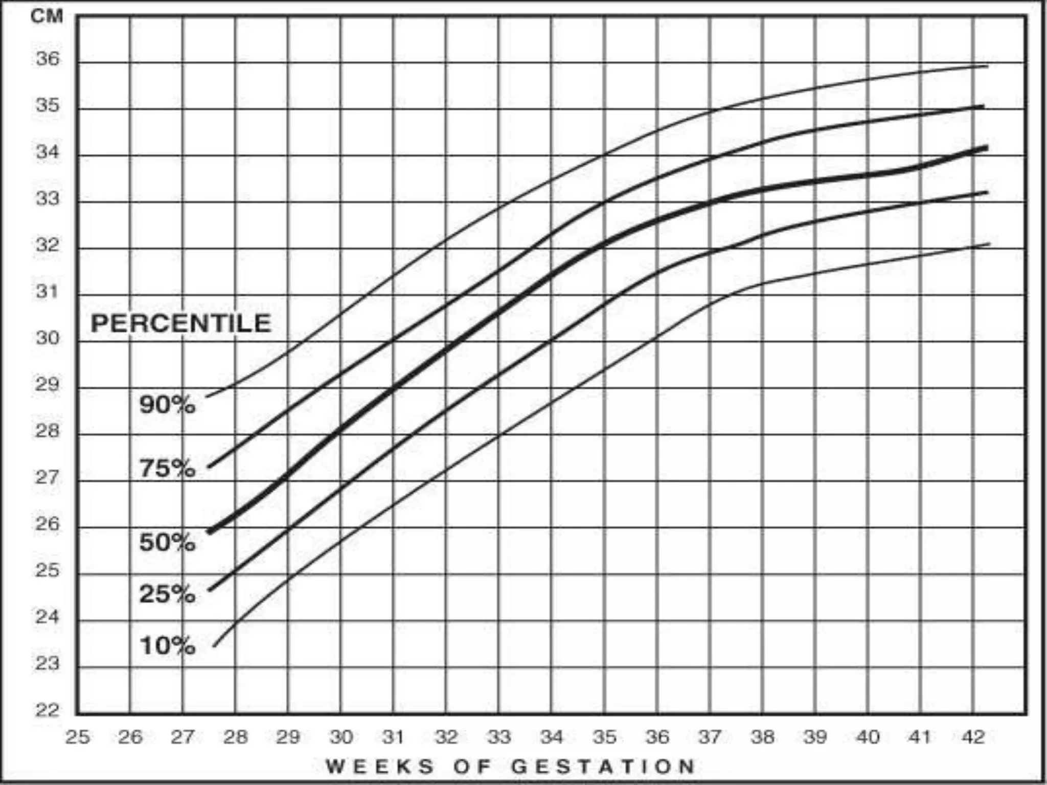 Hydrocephalus diagnosis and management | PPTX