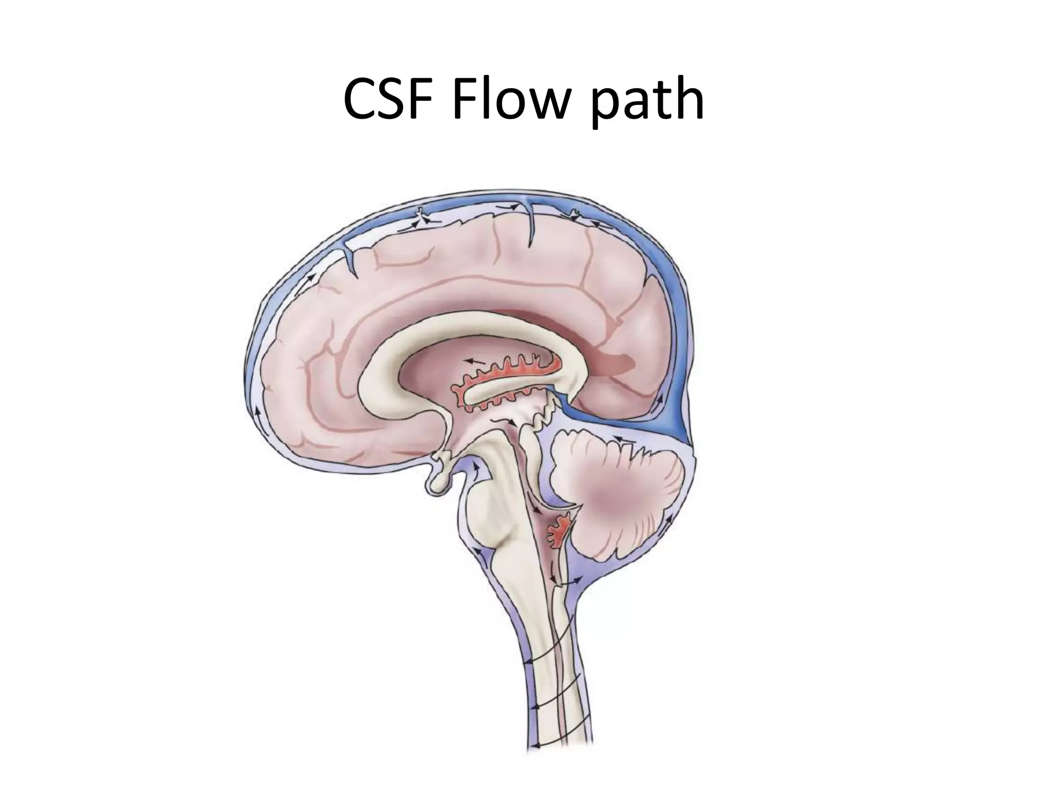 Hydrocephalus diagnosis and management | PPTX