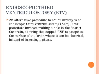 Hydrocephalus | PPT