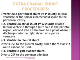 Hydrocephalus | PPTX