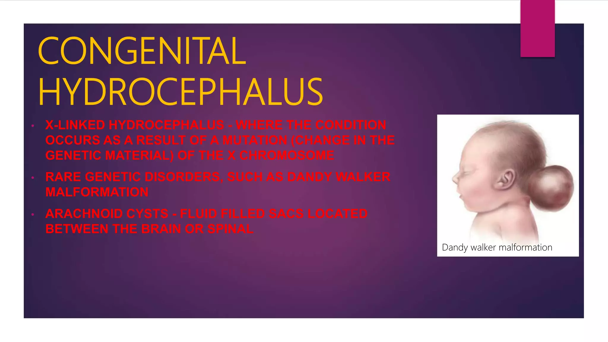Hydrocephalus | PPT