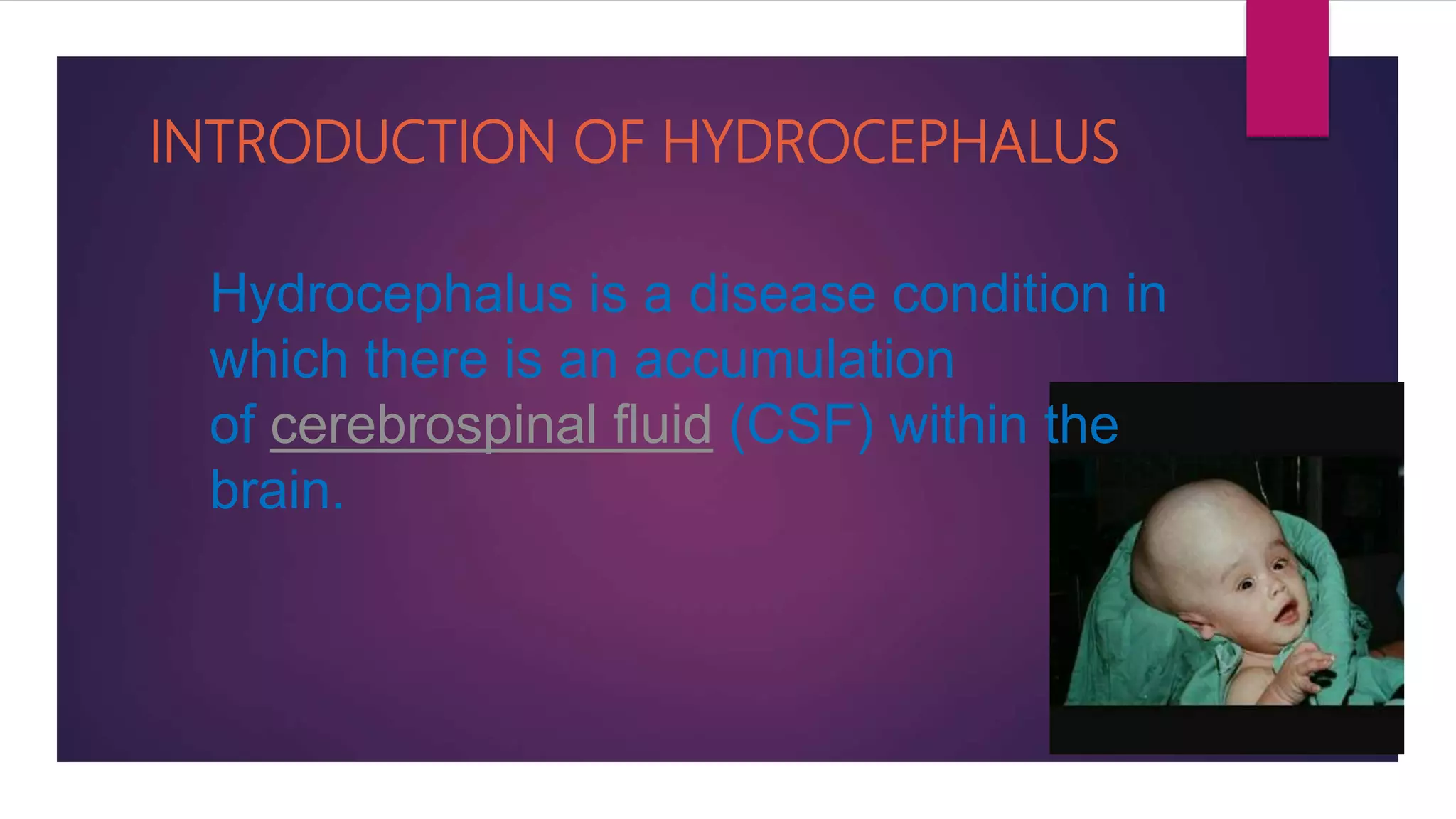 Hydrocephalus | PPT