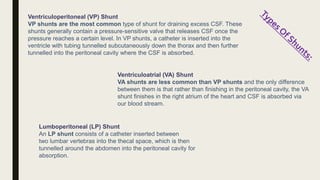 Hydrocephalus (Clinical Anatomy of CSF) By Muhammad Arslan Yasin | PPTX ...