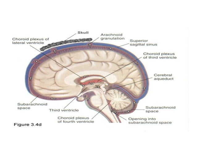Hydrocephalus | PPTX | Brain and Nervous System Disorders | Diseases ...