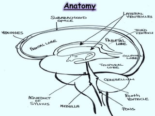 Hydrocephalus | PPTX