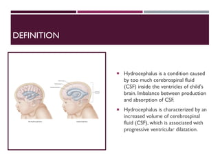 Hydrocephalus | PDF