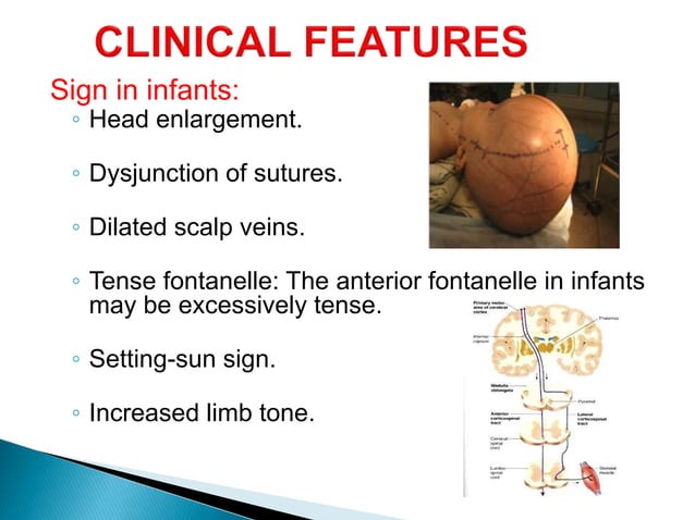 HYDROCEPHALUS | PPTX | Brain and Nervous System Disorders | Diseases ...