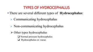 Hydrocephalus | PPTX
