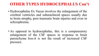 Hydrocephalus | PPTX