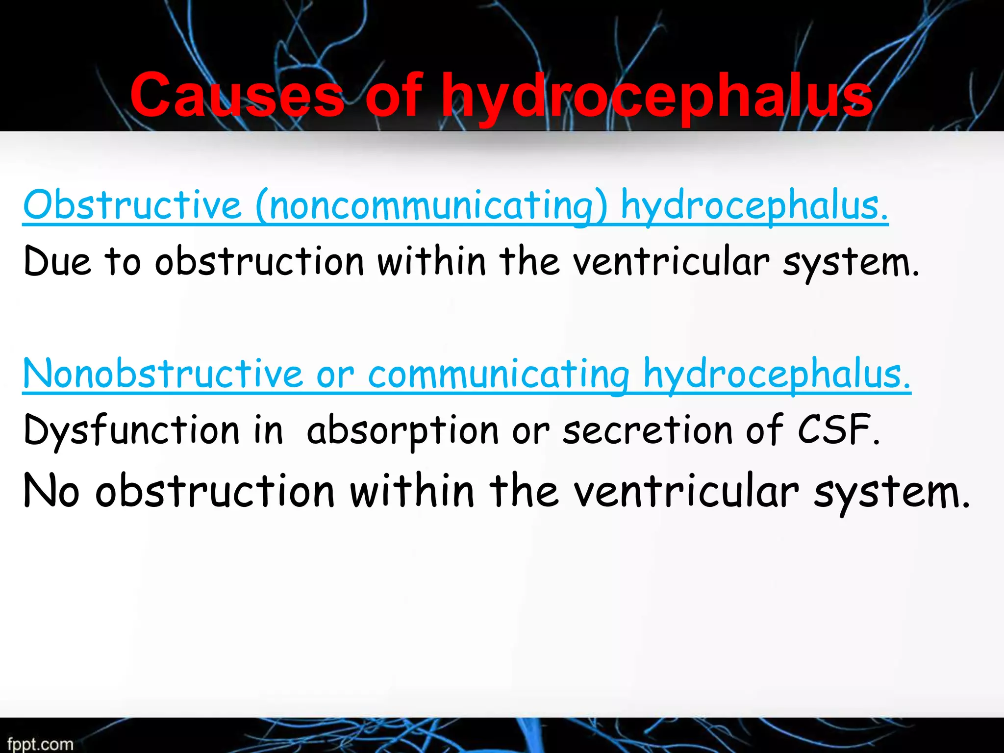 hydrocephalus.ppt