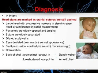hydrocephalus.ppt | Brain and Nervous System Disorders | Diseases and ...