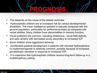 hydrocephalus.ppt
