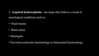 hydrocephalus.pptx