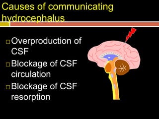 hydrocephalus.ppt