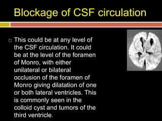 hydrocephalus.ppt
