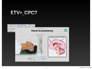 Hydrocephalus.pdf | Brain and Nervous System Disorders | Diseases and ...