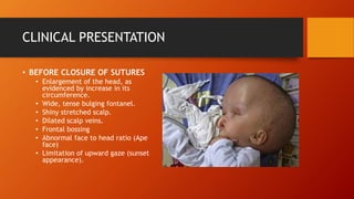 I LOVE NEUROSURGERY INITIATIVE: HYDROCEPHALUS.pptx