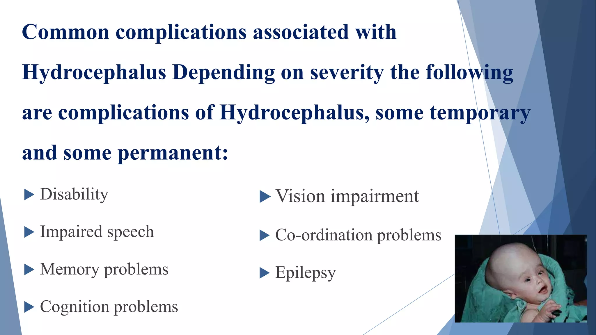 hydrocephalus.pptx