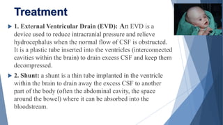 hydrocephalus.pptx