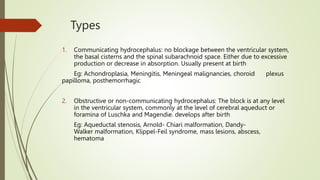 Hydrocephalus.pptx