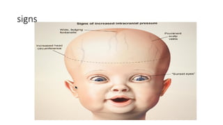 Hydrocephalus symptoms and treatment ppt | PPT