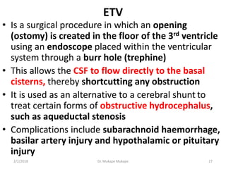 Congenital of the new born Hydrocephalus.pdf