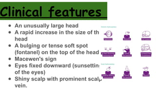 Hydrocephalus .pptx presentation in nursing | PPTX