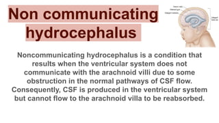 Hydrocephalus .pptx presentation in nursing | PPTX