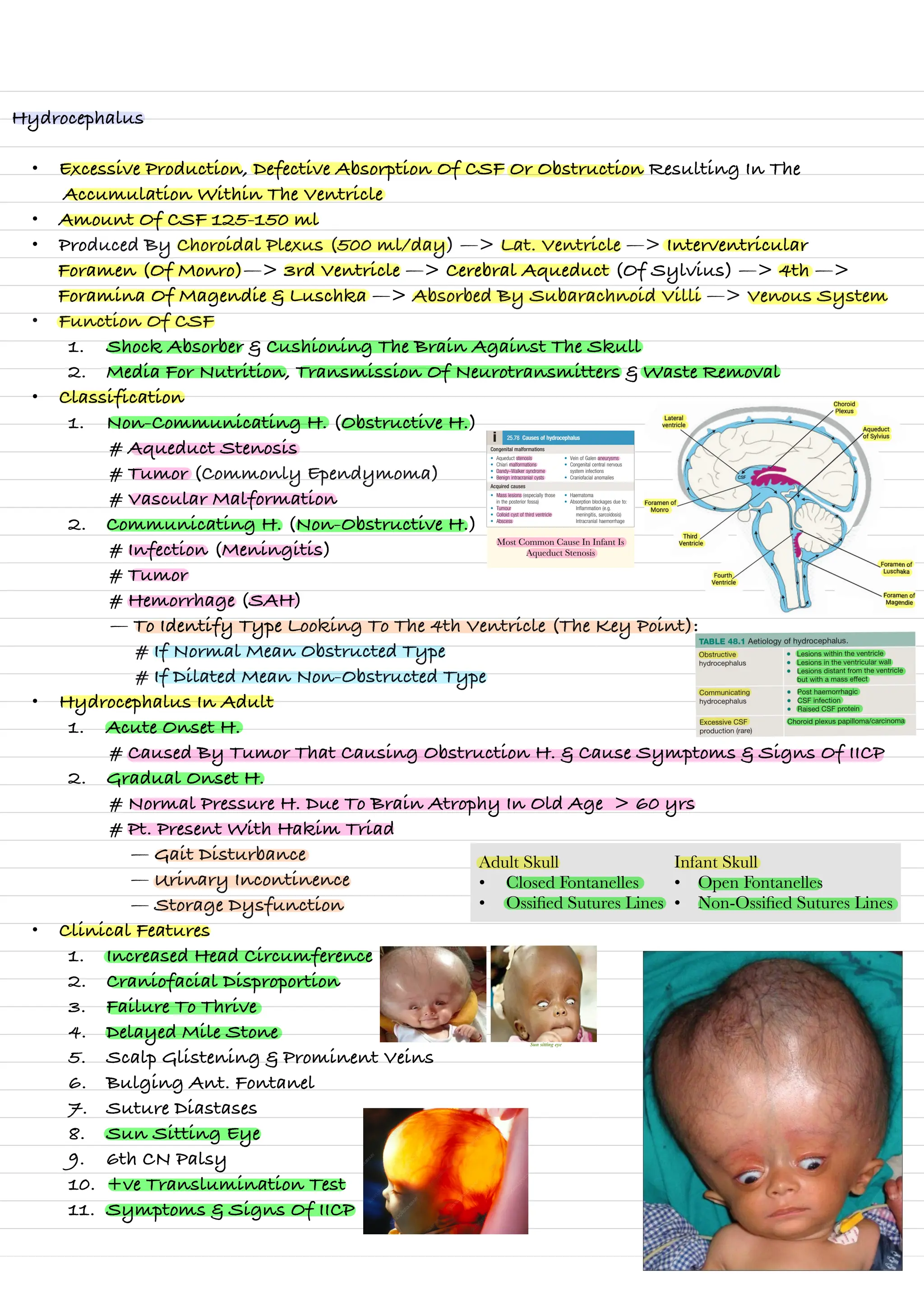 Hydrocephalus (neurology & neurosurgery).pdf