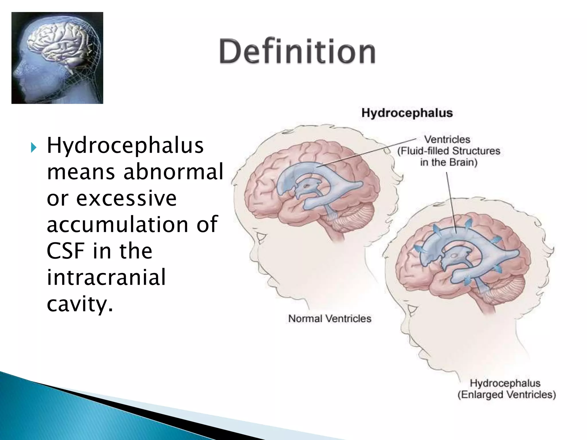 Hydrocephalus - Case Presentation (2).ppt
