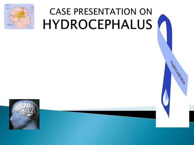 Hydrocephalus - Case Presentation (2).ppt | Brain and Nervous System ...