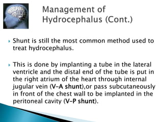 Hydrocephalus - Case Presentation (2).ppt
