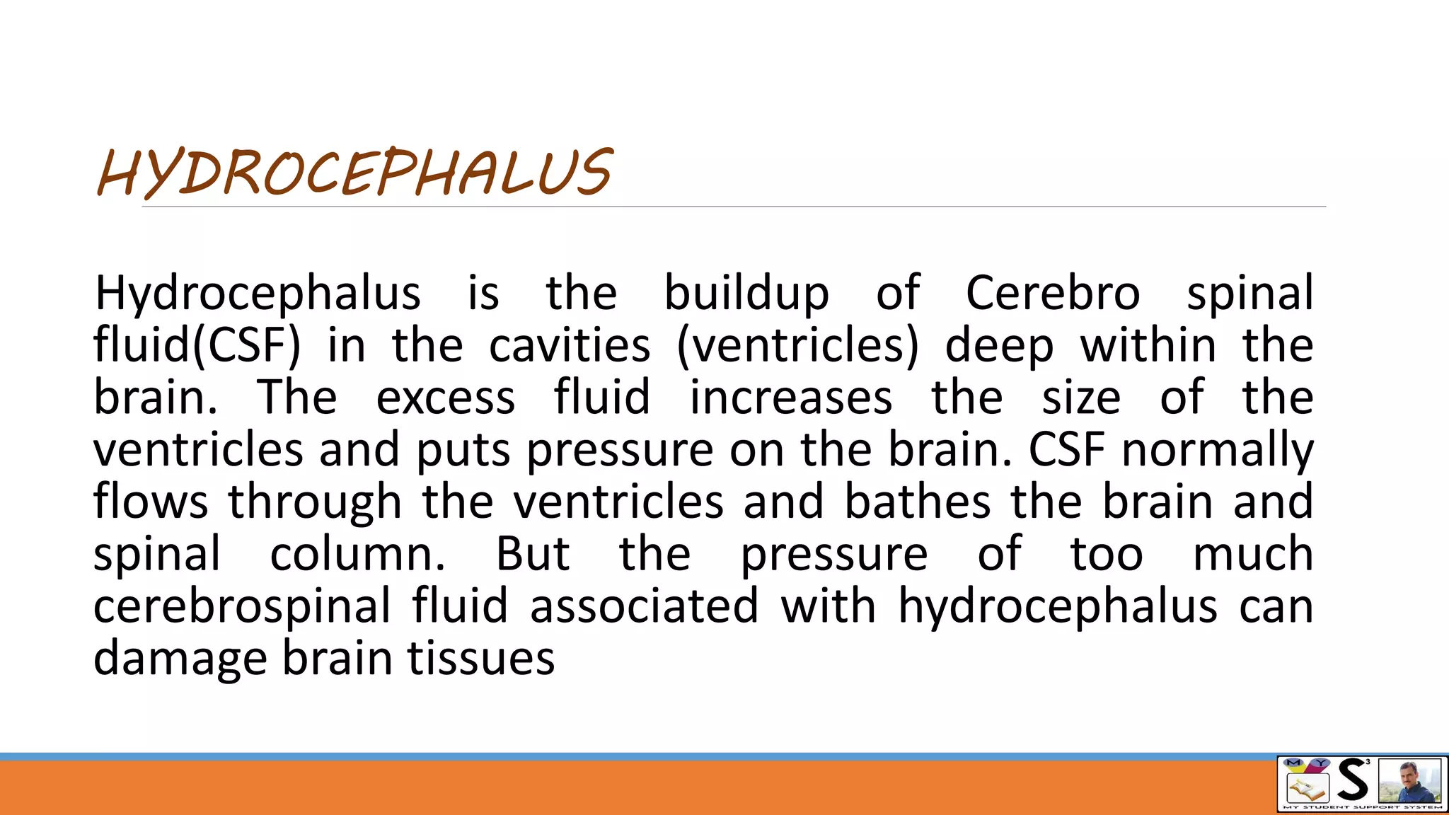 Hydrocephalus english | PPTX | Brain and Nervous System Disorders | Diseases and Conditions