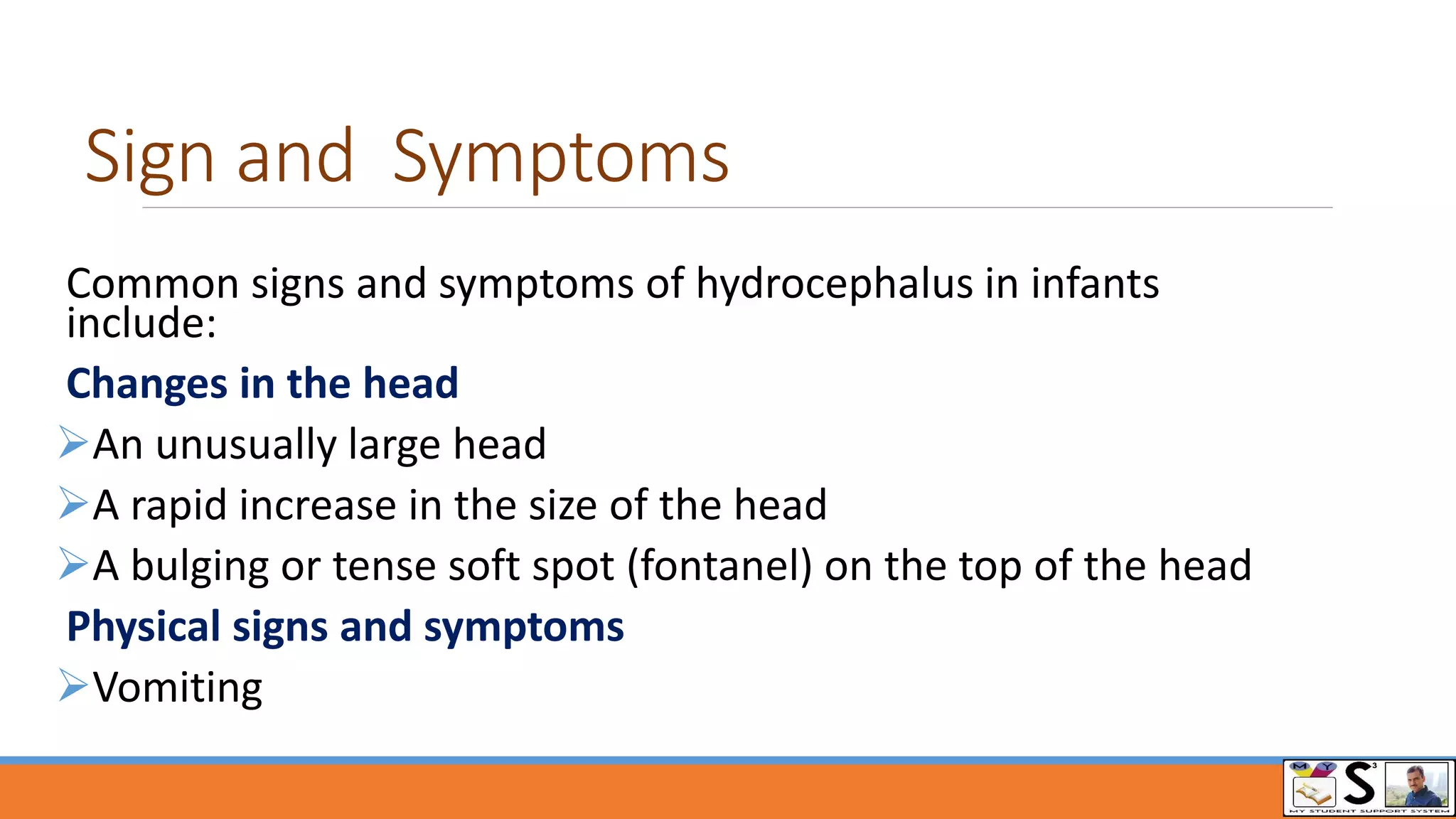 Hydrocephalus english | PPTX