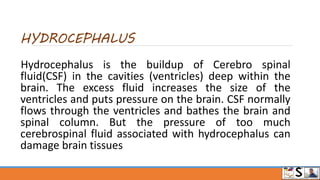 Hydrocephalus english | PPTX