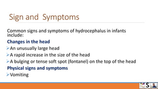 Hydrocephalus english | PPTX | Brain and Nervous System Disorders ...