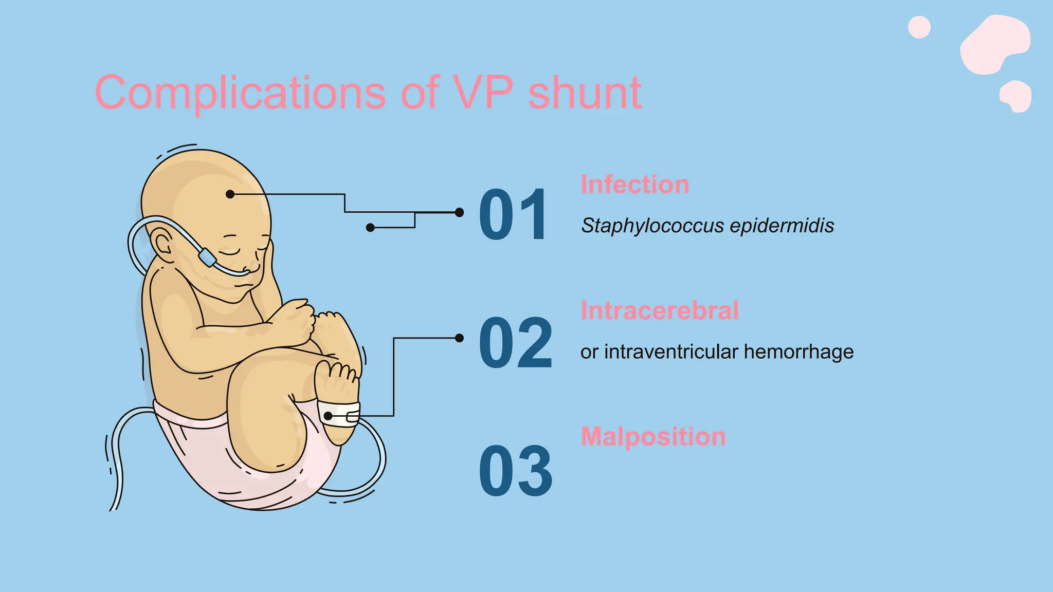 Hydrocephalus in neonates -Marwa Chehadeh.pptx