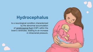Hydrocephalus in neonates -Marwa Chehadeh.pptx