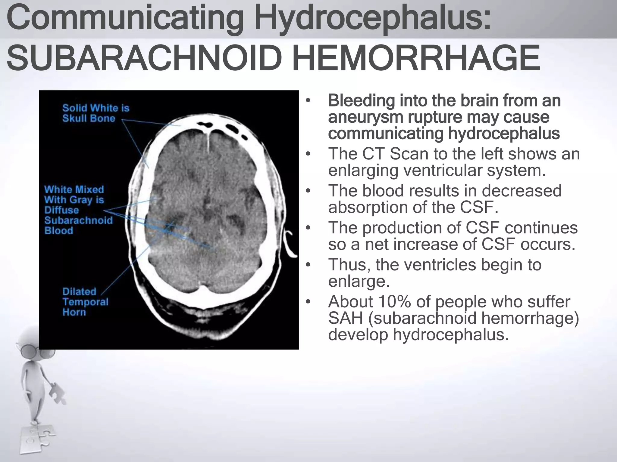Hydrocephalus and it's causes | PPT