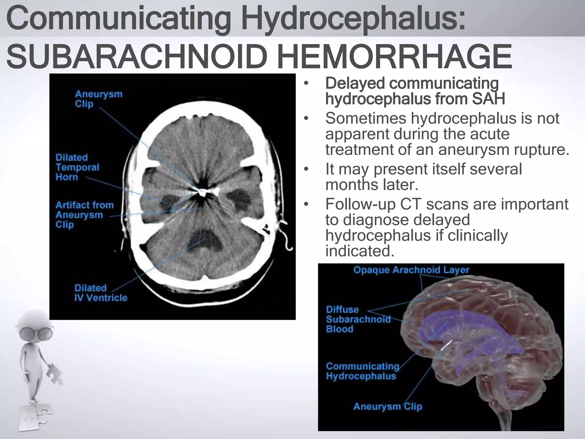 Hydrocephalus and it's causes | PPT