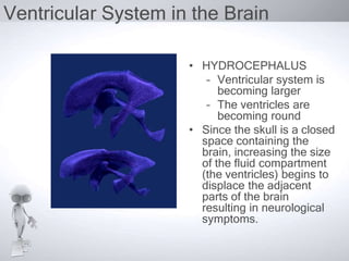Hydrocephalus and it's causes | PPTX