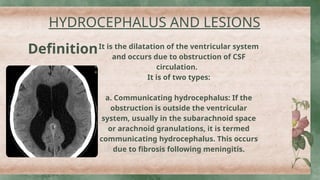 Hydrocephalus and lesions by V.K.sravani | PPTX
