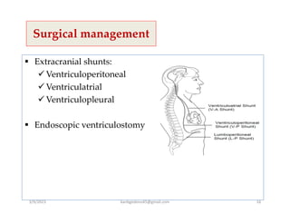 Hydrocephalus and Neural tube defect.pdf