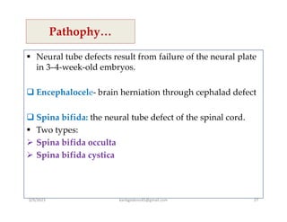 Hydrocephalus and Neural tube defect.pdf