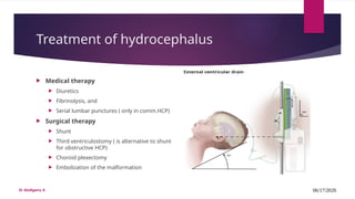 Comprehensive Overview of Hydrocephalus and Neural Tube Defects ...